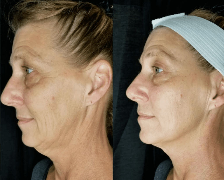 CryoSkin - Transformations Esthetics & Wellness